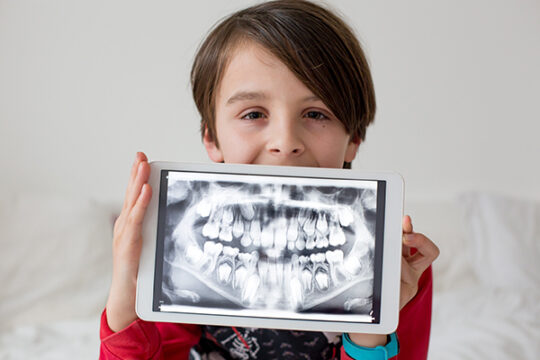 ️ ¿Dientes supernumerarios? Conoce cómo tratar esta condición